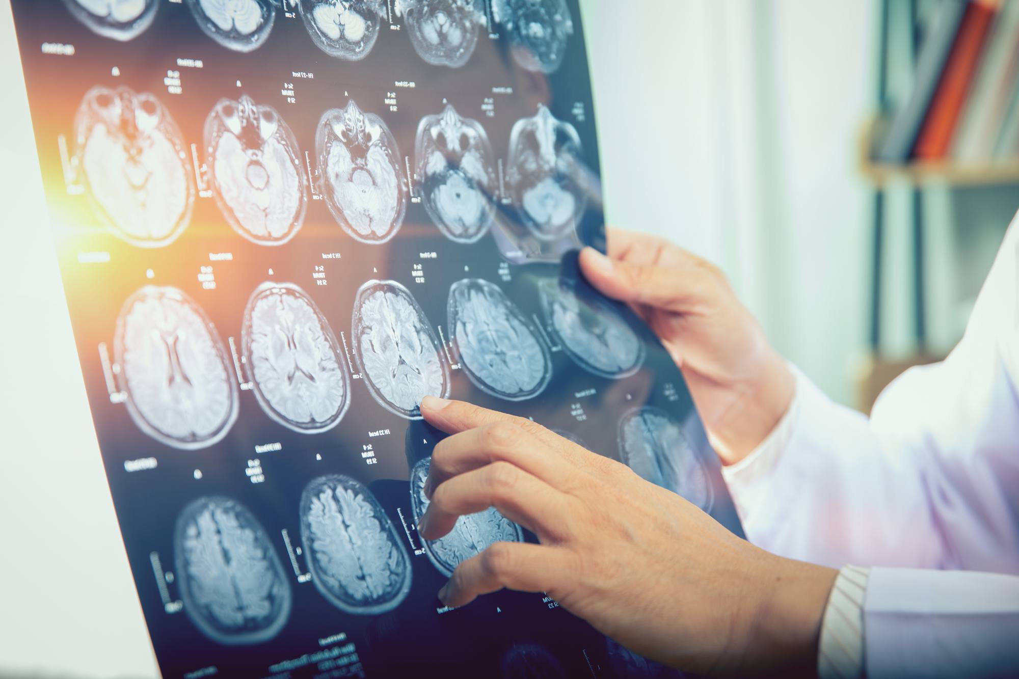 Neurology Imaging | Medpace