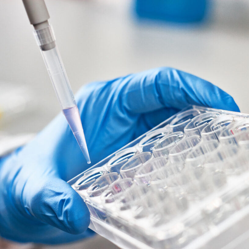 Neutralizing Antibody Assays | Medpace Bioanalytical Lab