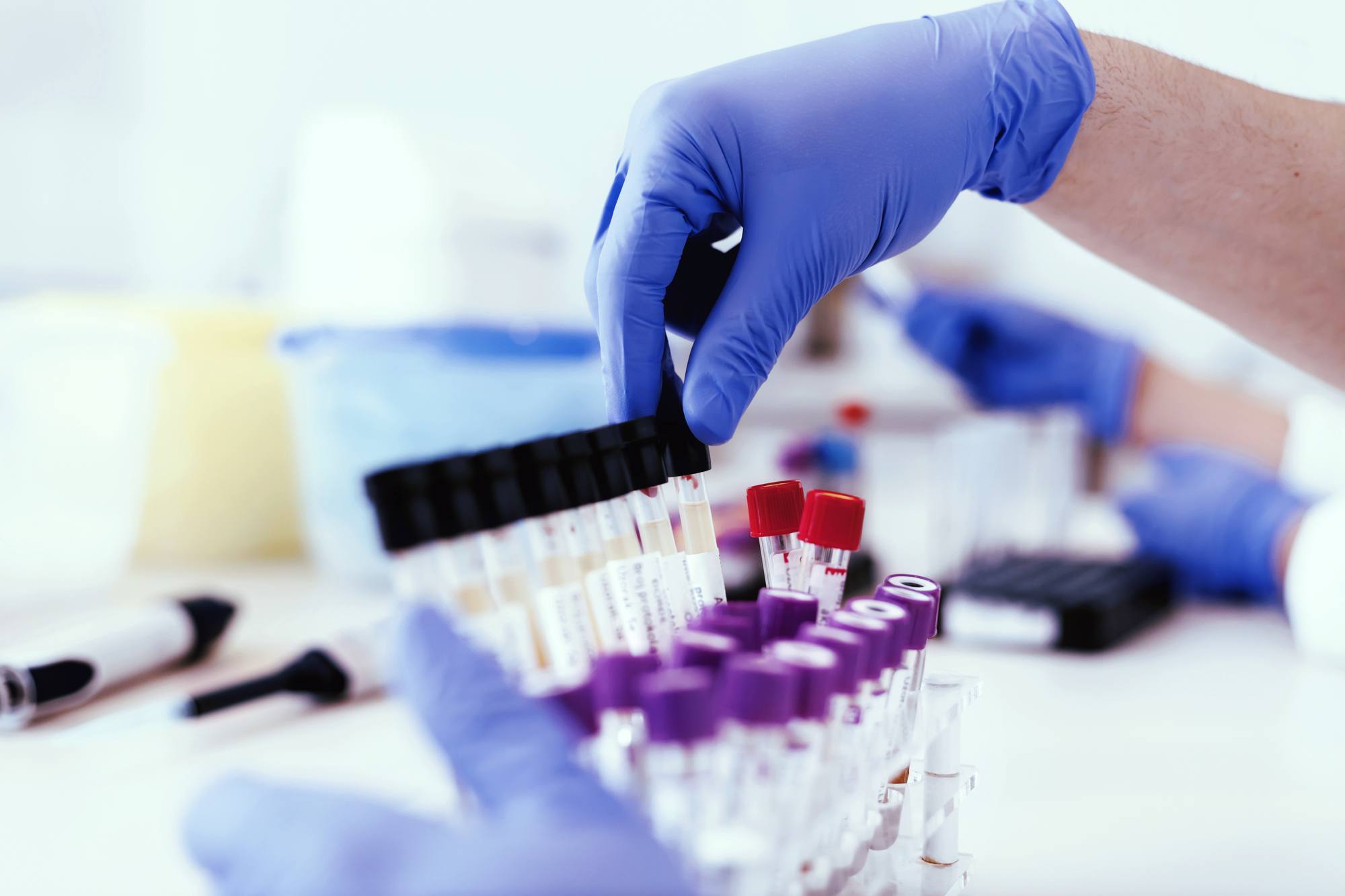 Biomarker Assays | Medpace Bioanalytical Lab