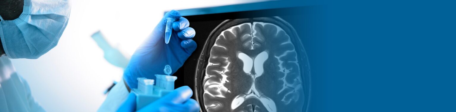 [Webinar] Achieving Success in Neuroscience Clinical Trials: An ...