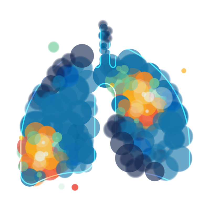Respiratory CRO | Medpace