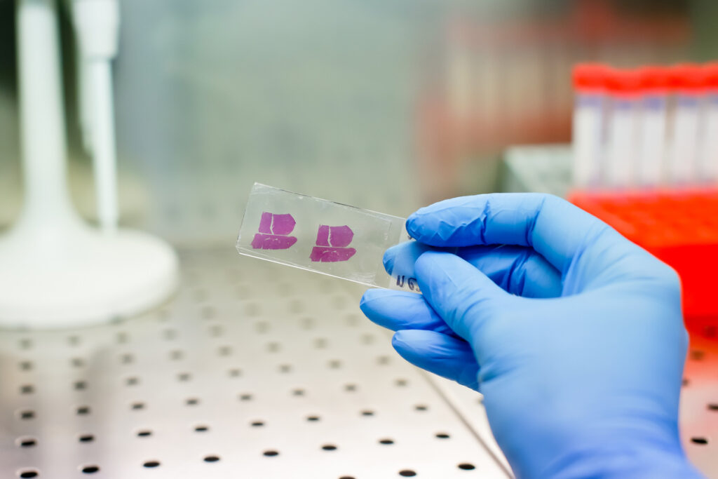 Interactive Response Technology (IRT) | Medpace