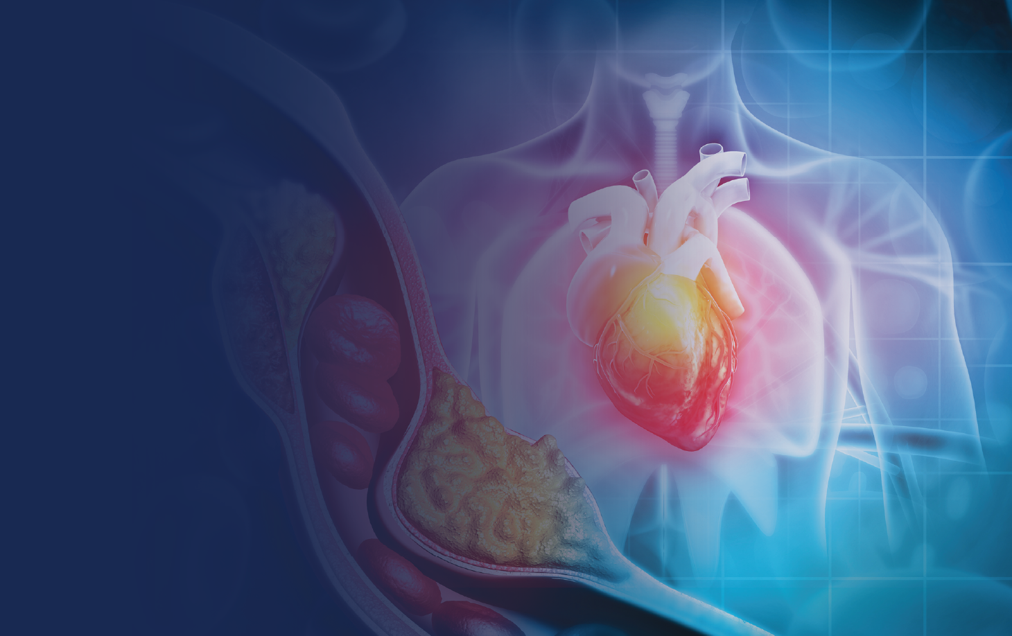 [On-Demand Webinar] Advancing Atherosclerotic Cardiovascular Disease ...